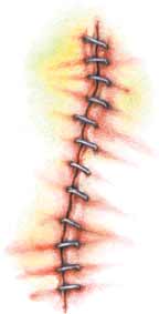 Stitched Wound Tattoo – Tattoo for a week